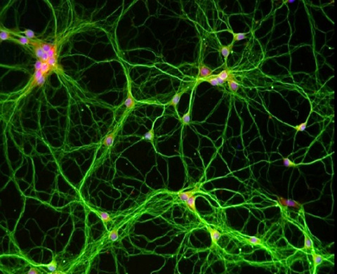 Metabolic enzyme drives memory formation | Iowa Neuroscience Institute ...